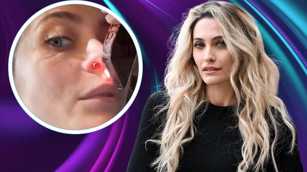 Paris Jackson, Muestra El “hueco En Su Nariz”